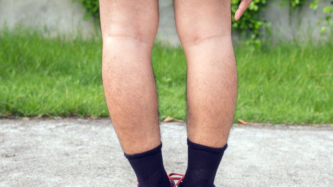 Shoes for Women with Knock Knees - Improve The Way You Walk ...